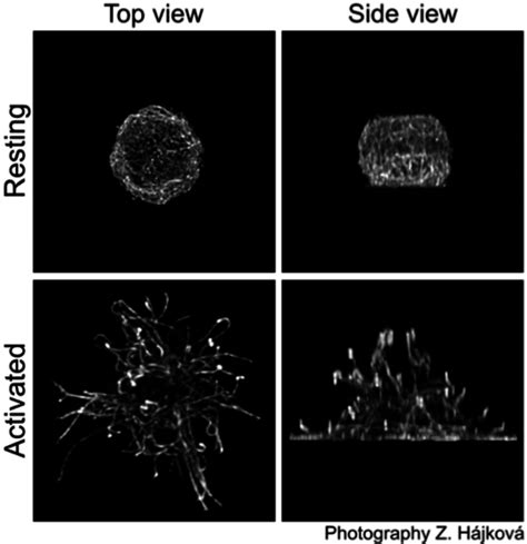 Microtubules and mast cell signaling – EMBRN – European Mast Cell and ...