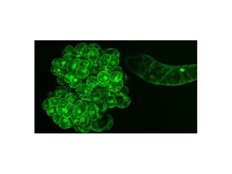 Image result for Confocal Microscopy Tutorial