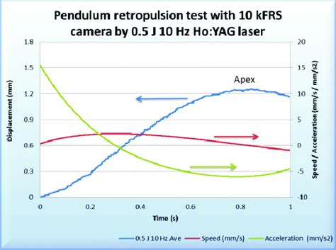 Image result for Retropulsion Test Procedure