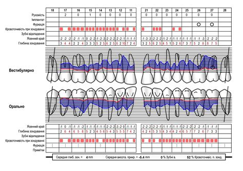 Image result for How to Read a Perio Chart