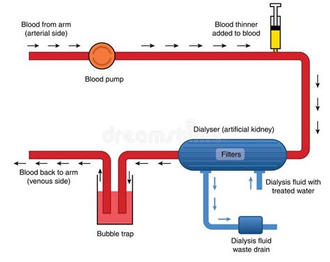 Image result for How Does a Dialysis Machine Work