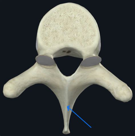 Image result for Sharp Slender Process