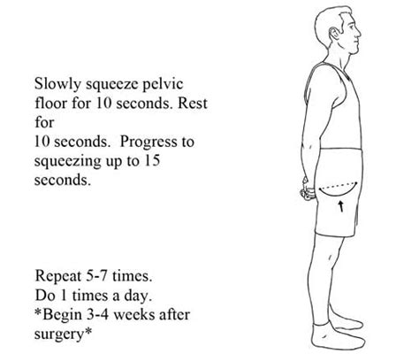 Image result for Exercise After Radical Prostatectomy