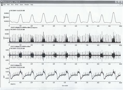 Image result for MATLAB EMG Filter