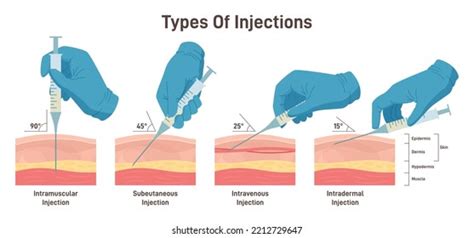 Intramuscular Injection Sites Image Intramuscular Injection, 54% OFF