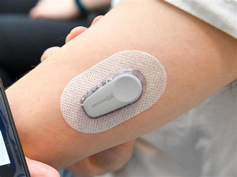 Image result for Dexcom Sensor Placement