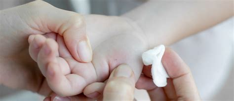 Image result for Drawing Ointment to Remove Splinter