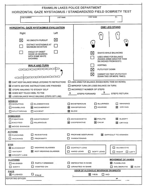 Image result for SFST Field Notes
