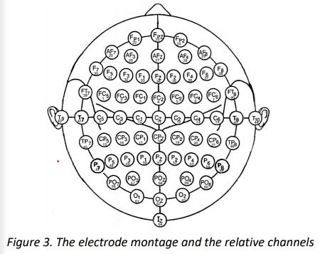Image result for MATLAB EMG Filter