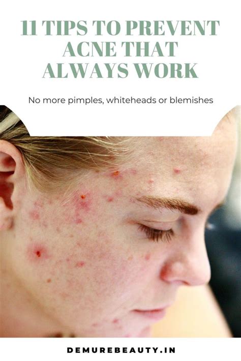 Image result for How to Avoid Pimples