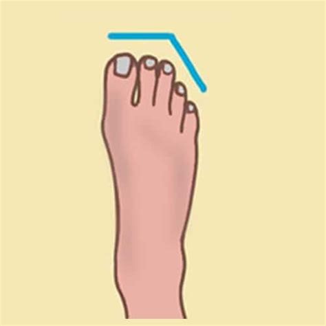 Image result for Different Types of Toes