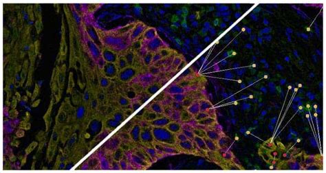 Image result for Multiplex IHC Texture Types Diffuse