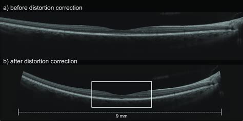 Image result for Oct Line Scan