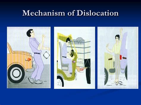 Image result for Dislocation Mutagenesis