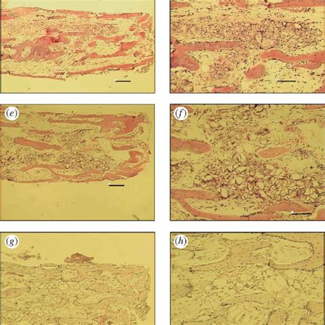 Image result for Normal Bone Formation