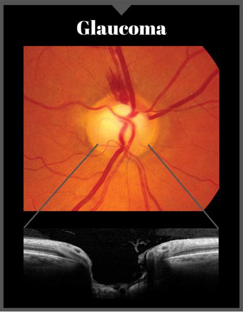 Image result for Retinal Imaging