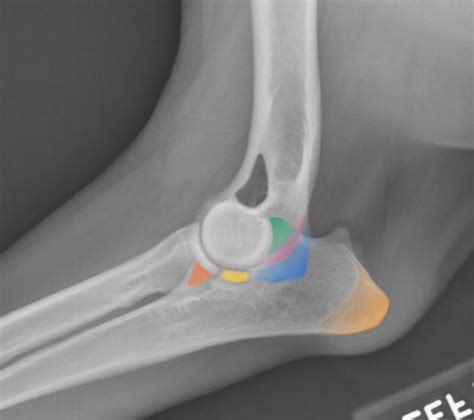 Image result for Prototype 2 Elbow Drop