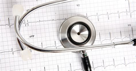 Image result for Normal Heart Rate Dog