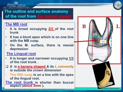 Image result for Maxillary First Molar