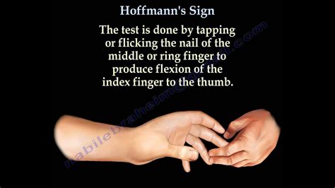 Image result for Tromner Sign Demonstration