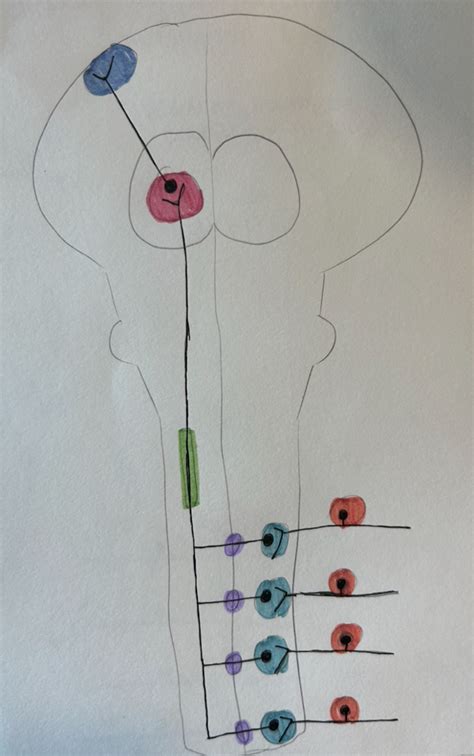 Image result for Spinothalamic Pathway Content