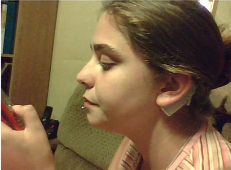 Image result for Using a Phone with Cochlear Implant