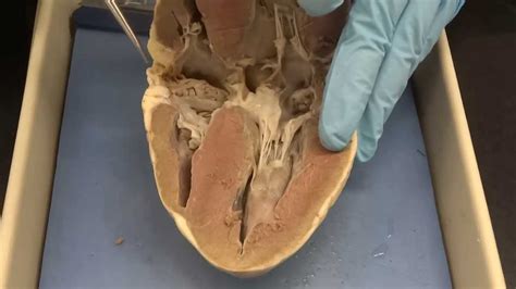 Image result for Human Heart Dissection