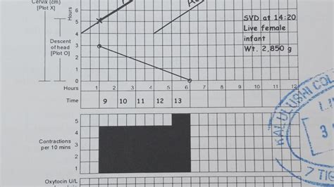 Image result for Types of Partograph