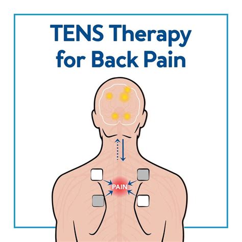 Image result for Tens Machine Lower Back