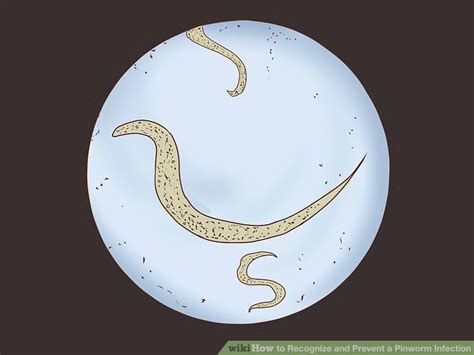 Image result for Pinworm Skin