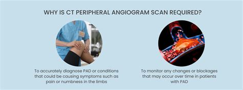 Image result for Peripheral Angiogram