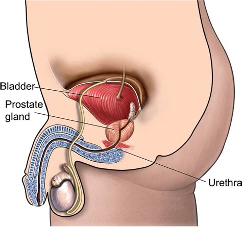 Image result for Prostatectomy Surgery Procedure