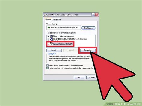 Image result for DHCP Is Not Enabled for Local Area Connection