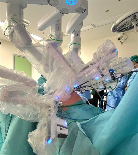 Image result for Robotic Prostatectomy Procedure