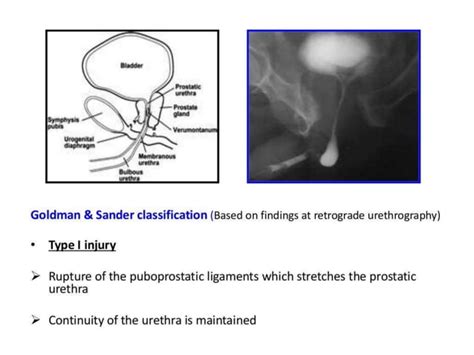 Image result for Urethrogram Procedure