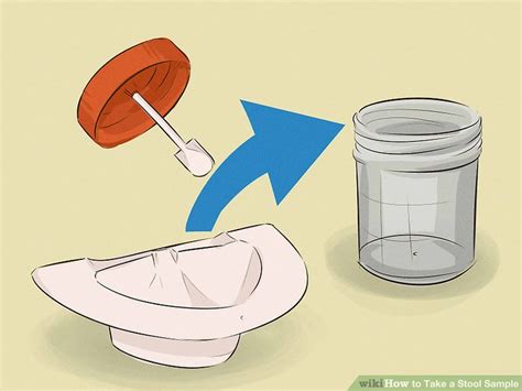 Image result for How to Get Stool Sample