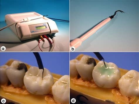 -The ECM device (Version 4) and its clinical application. (a) The ECM ...