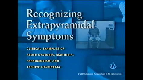 Image result for Extrapyramidal Signs