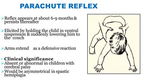 Image result for Neonatal Primitive Reflexes