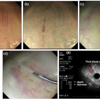 Image result for RDI Camera
