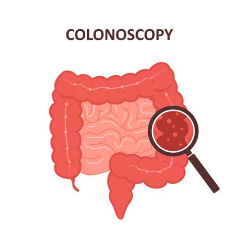 Image result for Colonoscopy Cartoon