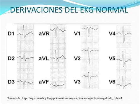 Image result for ECG 12 Derivaciones Normal