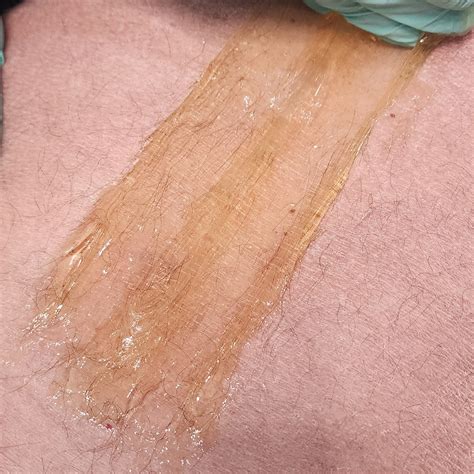 Image result for Sugaring Tutorial