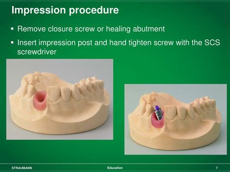 Image result for Impression Procedure