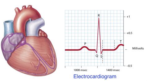 Image result for AV Node