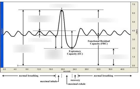 Image result for How to Read Spirogramm