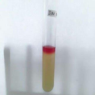 Image result for Indole Test Procedure