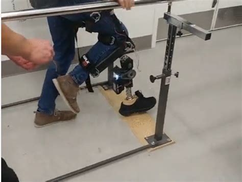 Image result for Raspberry Pi Prosthetic