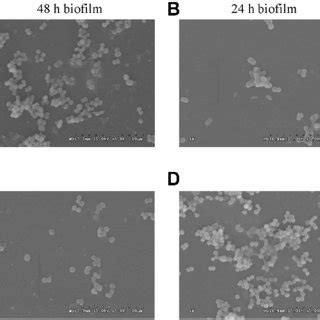 Image result for Scanning Electron Microscope Magnification