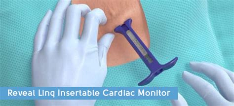 Image result for LINQ Device